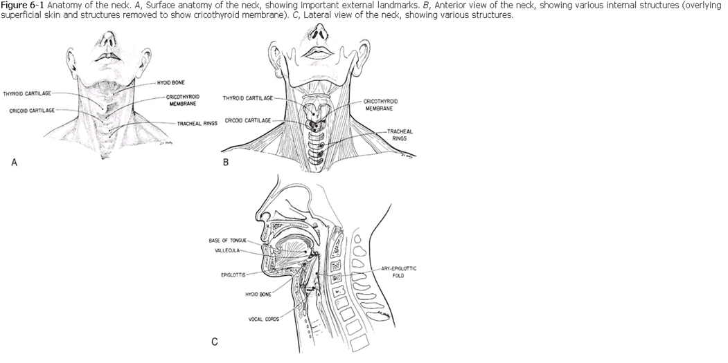 Percutaneous dilatational tracheostomy (PDT) « Review of Critical Care ...