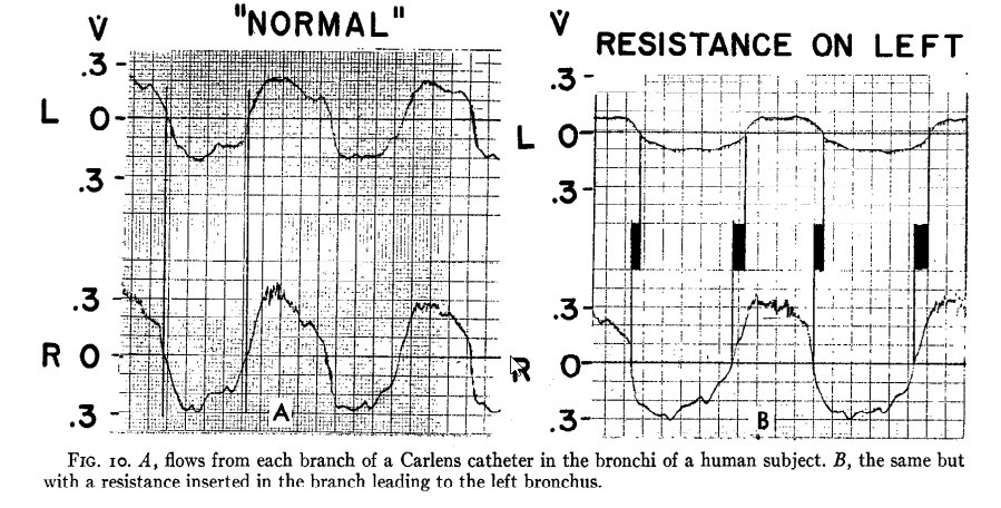 Time Constant of Lungs « Review of Critical Care Medicine